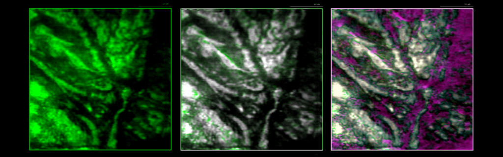 Welcome to » DVD Laser Scanner Microscope